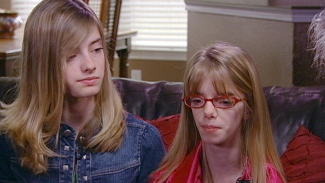 Twins Only Known Pair With A Primordial Dwarf Video Abc News