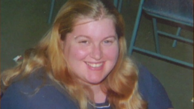 Michigan Woman Has Same Flesh Eating Disease Aimee Copeland Survived